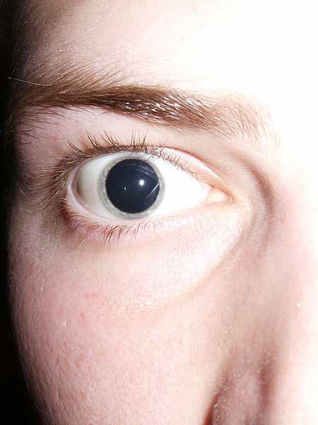 Pupil Dilation PsychonautWiki